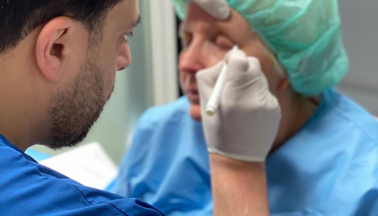 Wat is een ooglidcorrectie? En welke zijn er? - Dutch Clinic